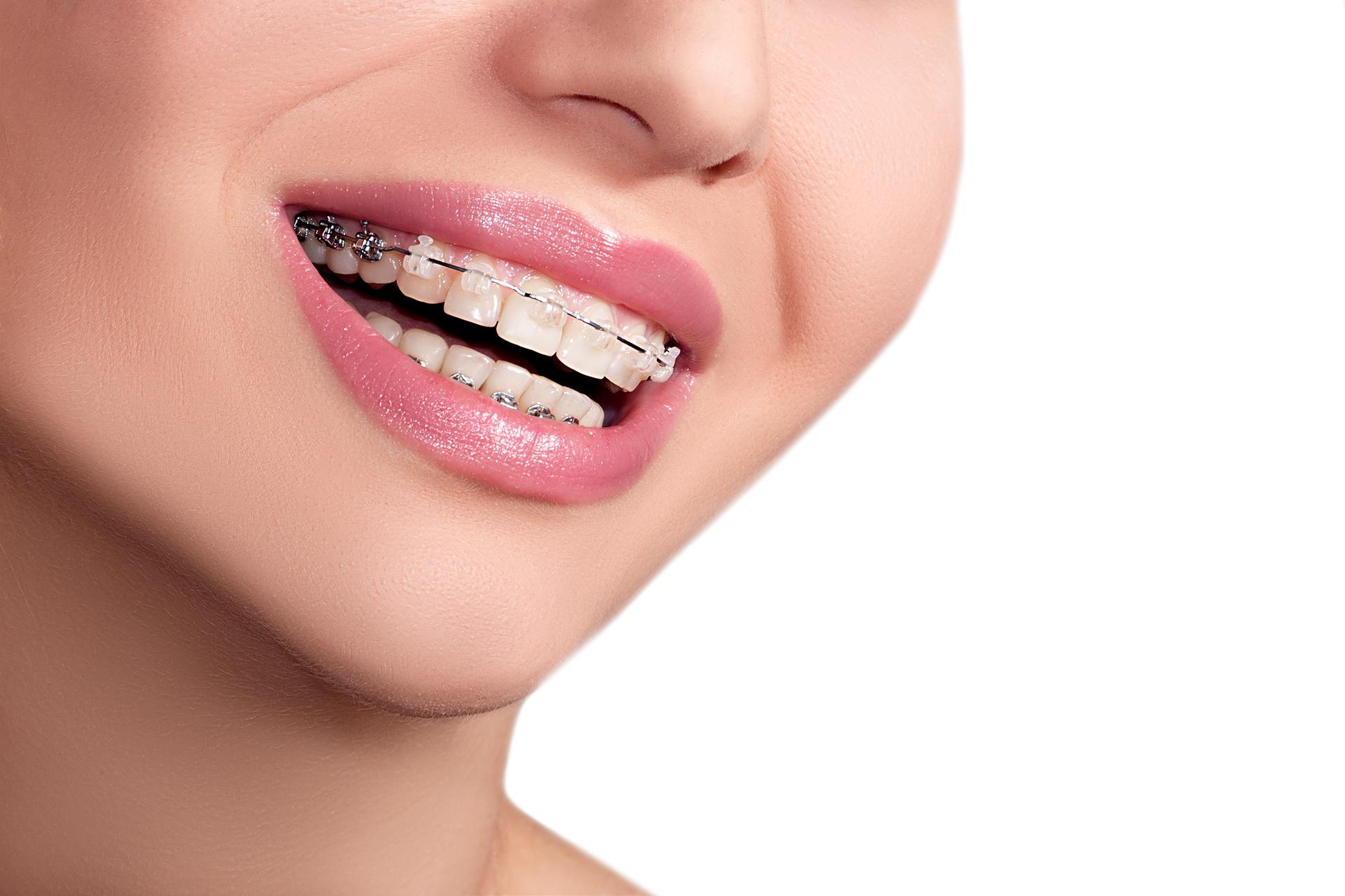 Dental Chandausi Dental Clinic