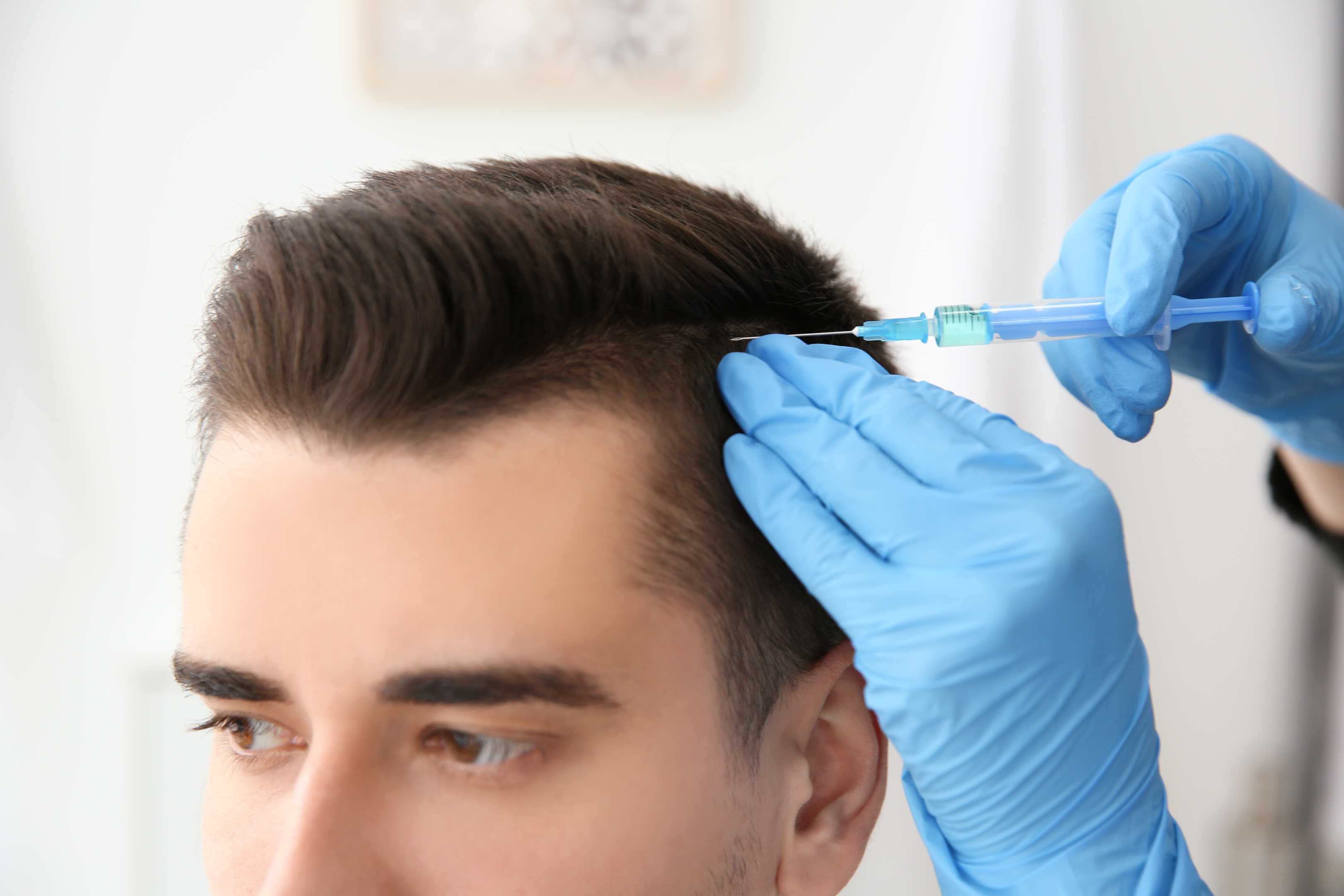 Fue Follicular Unit Extraction Hair Restoration Hair Loss Centre