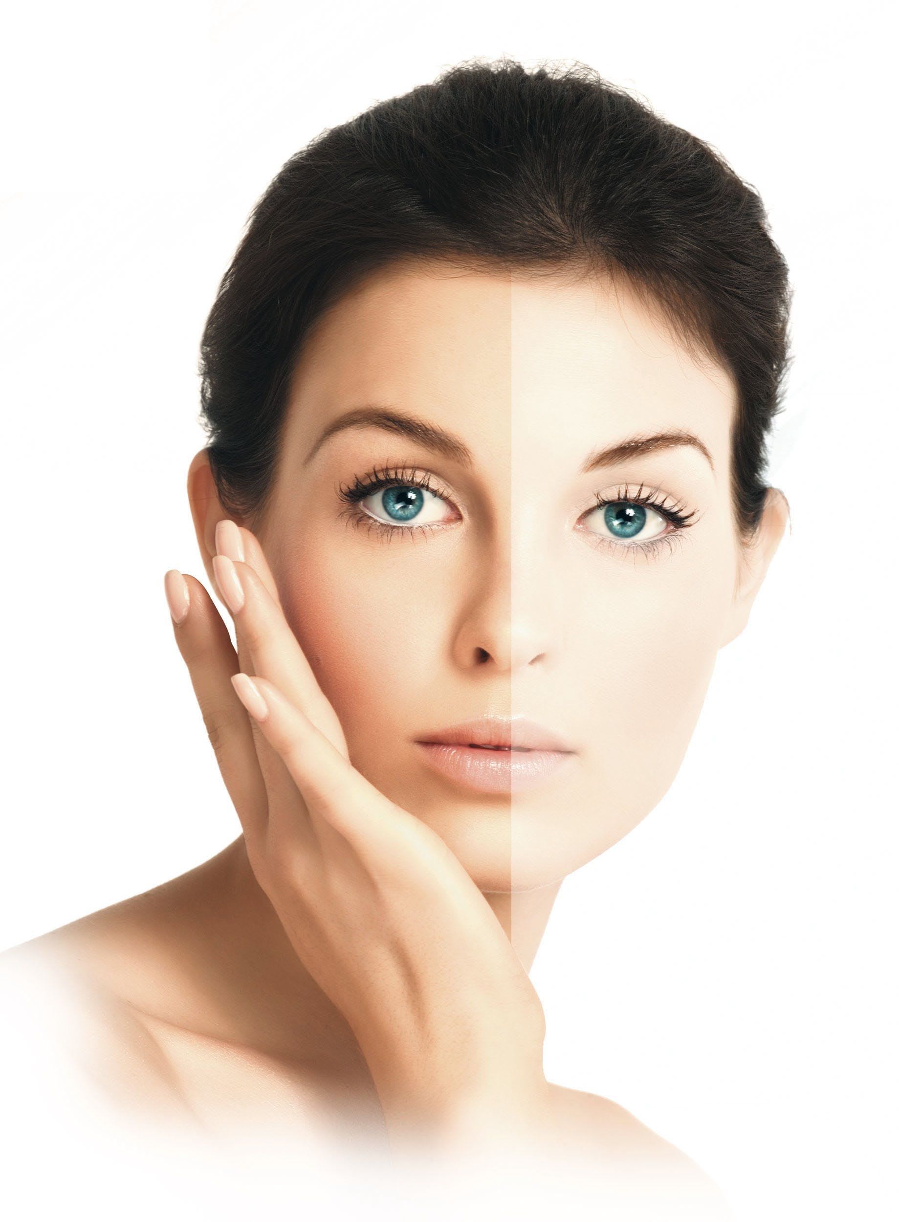 SnowCell Brightening Treatment - Acne, Scars & Facial Spots - Evgenia