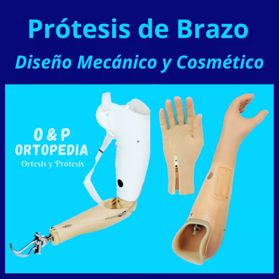 Prótesis de brazo - Productos - Ortopedia Oyp Ortesis y Prótesis | Huancayo