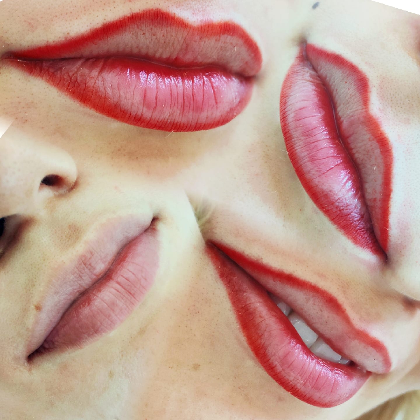 Full Lip Blush - Lips - BBL Aesthetic Clinic - Beauty Treatments | Glasgow
