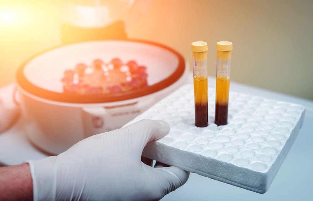 Regenerative Joint Injection Therapy - Treatments - Illuminate Me ...