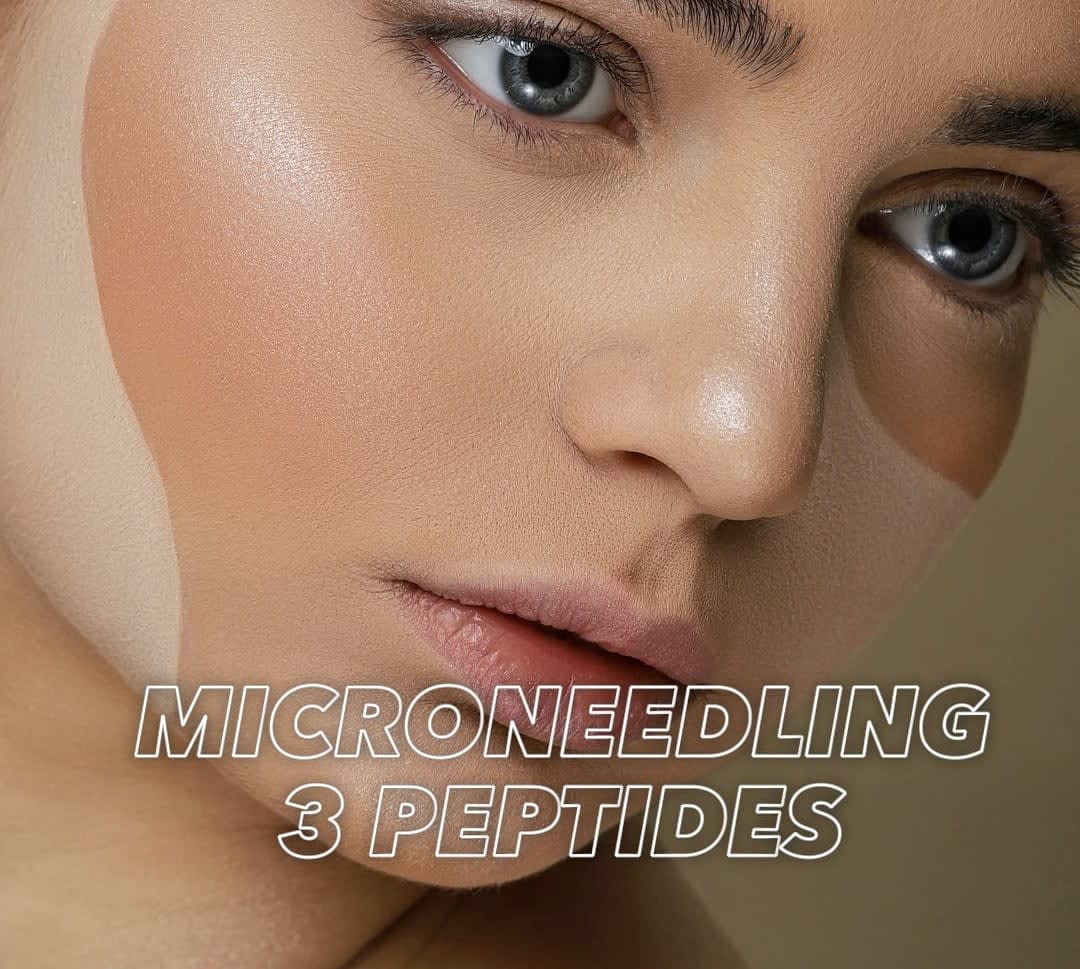 MICRONEEDLING - Facial Aesthetics - Skin Aesthetic - Health and Beauty ...