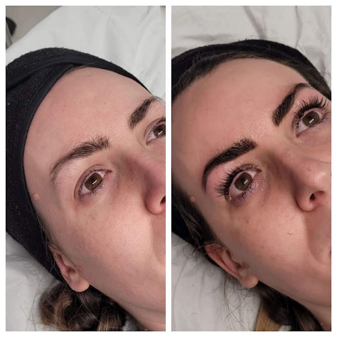 Dermaplaning - facial aesthetics - LKW Microblading - Eyelash & Eyebrow ...