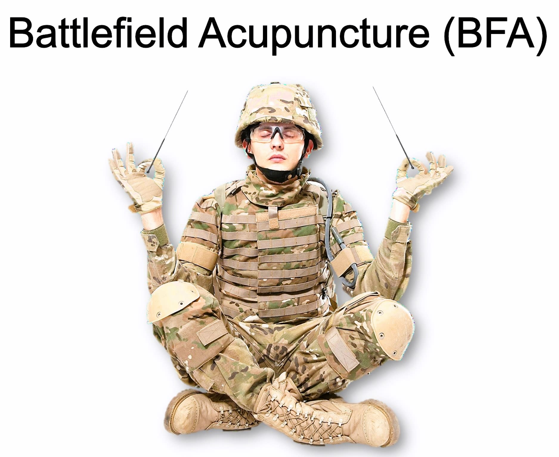 Battlefield Acupuncture - Health Care Treatments - ICARE: Center for ...