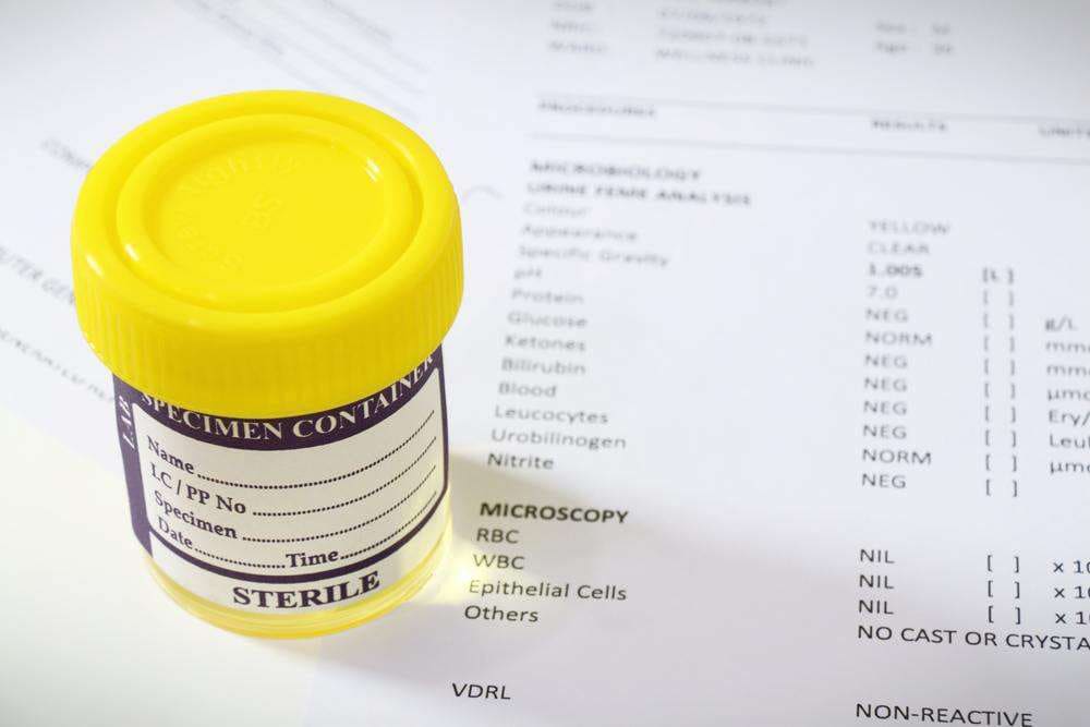 5 25 Panel Drug Test Drug Testing NFDS Specimen Collections 5-25-panel-drug-test-drug-testing-nfds-specimen-collections
