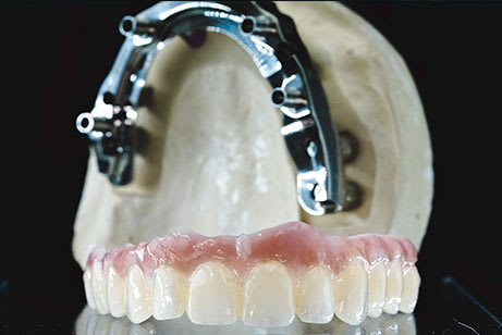 PMMA, Titanium Bar (Hybrid Denture), Full Zirconia - All On 4 - Making ...