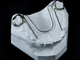 "W" Expander - Functional Appliances - Acrylic Designs Dental Lab ...