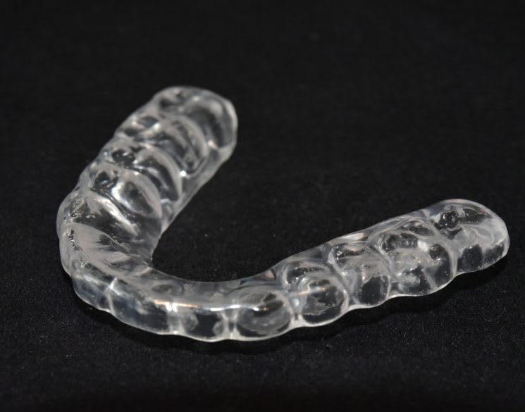 Upper and Lower Orthodontic Splints - Splints - Acrylic Designs Dental ...