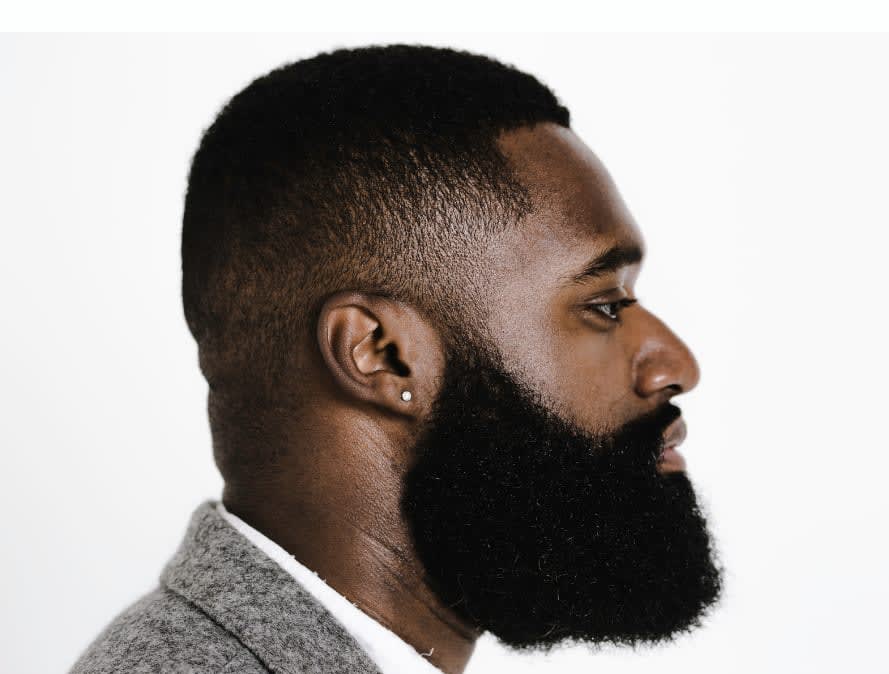 Facial Transplant (Beard, Sideburns, Moustache Transplant) - Hair ...