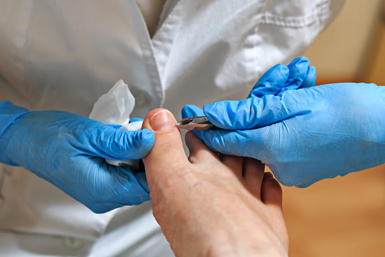 Toenail Clipping - Foot Health Treatments - Foot Focus Pembrokeshire ...