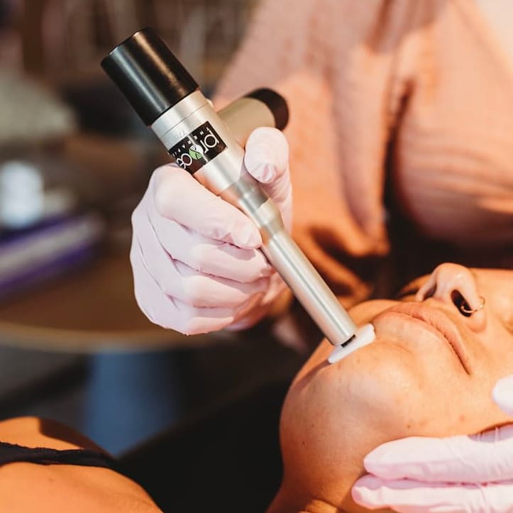 Microneedling w/ PROCELL PRO (original formula) Stem Cell Serum & Aftercare