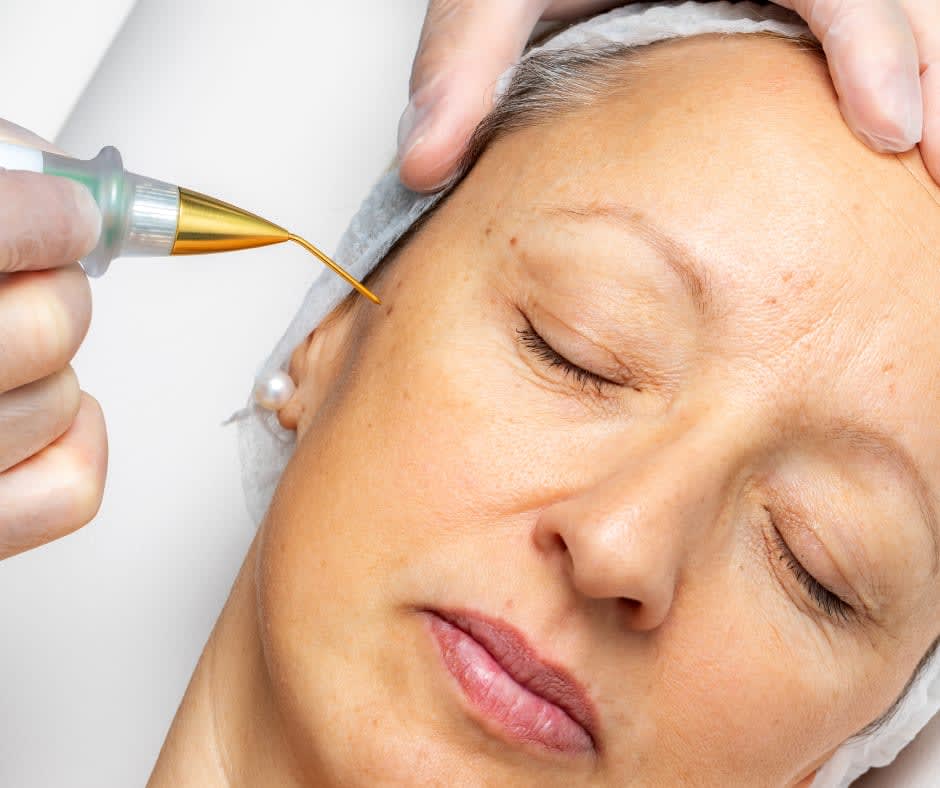 Skin Cancer Removal - Skin Cancer | Surgical Treatments - Unique ...