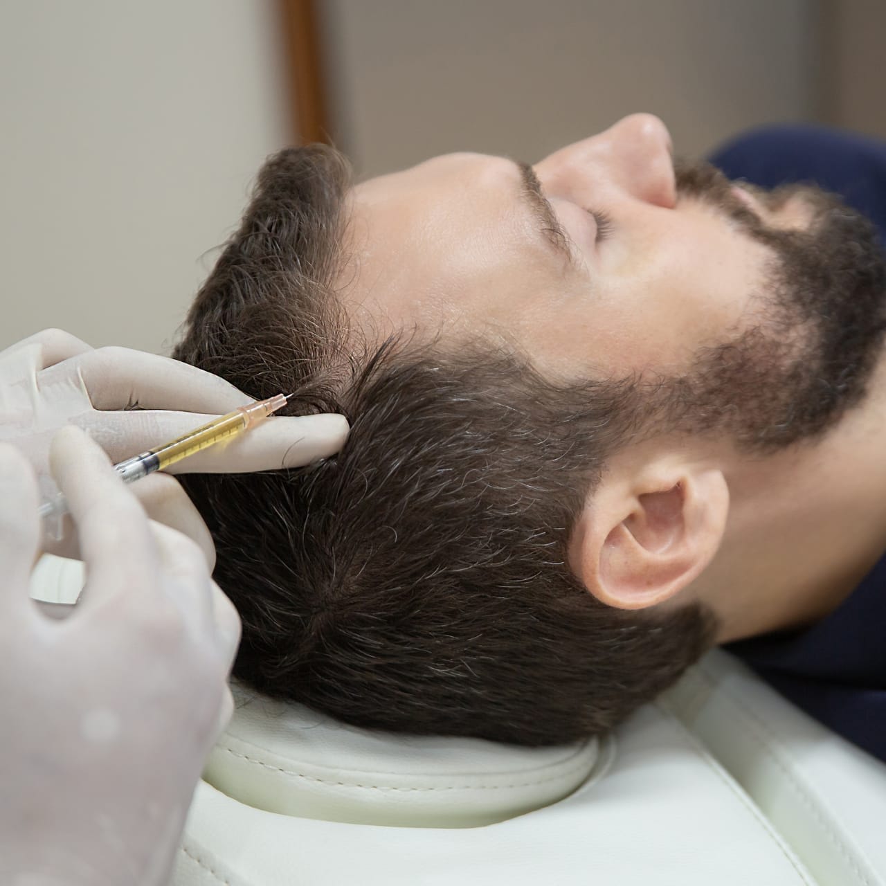 PRF INJECTIONS - Hair Loss - Skin Aesthetic - Health and Beauty in ...