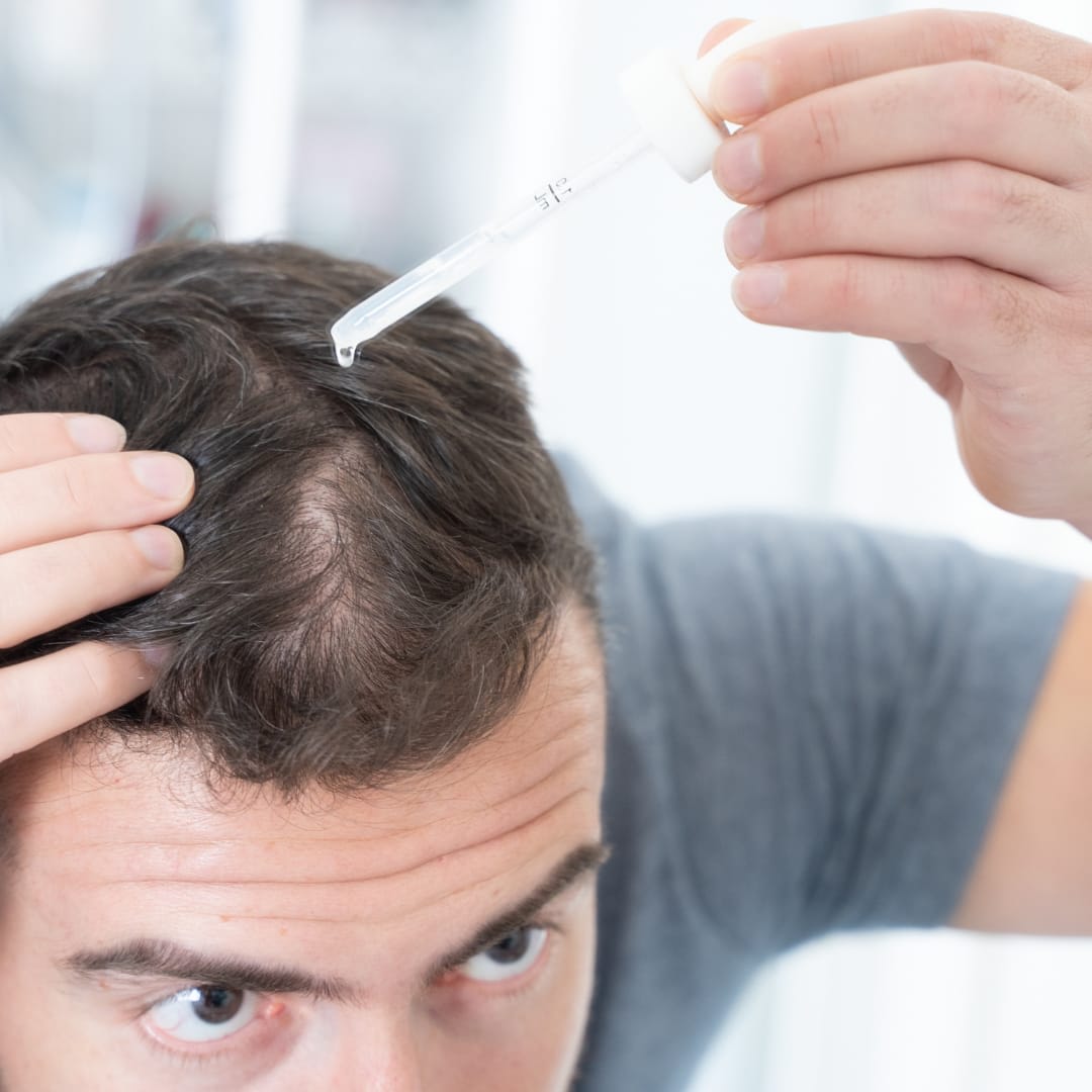 PRP & BIOTIN INJECTIONS - Hair Loss - Skin Aesthetic - Health and ...