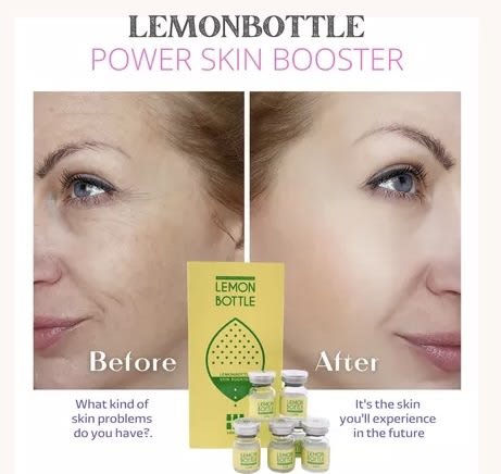 Lemon Bottle Skin Booster - Injectables - Eden Rose Aesthetics ...