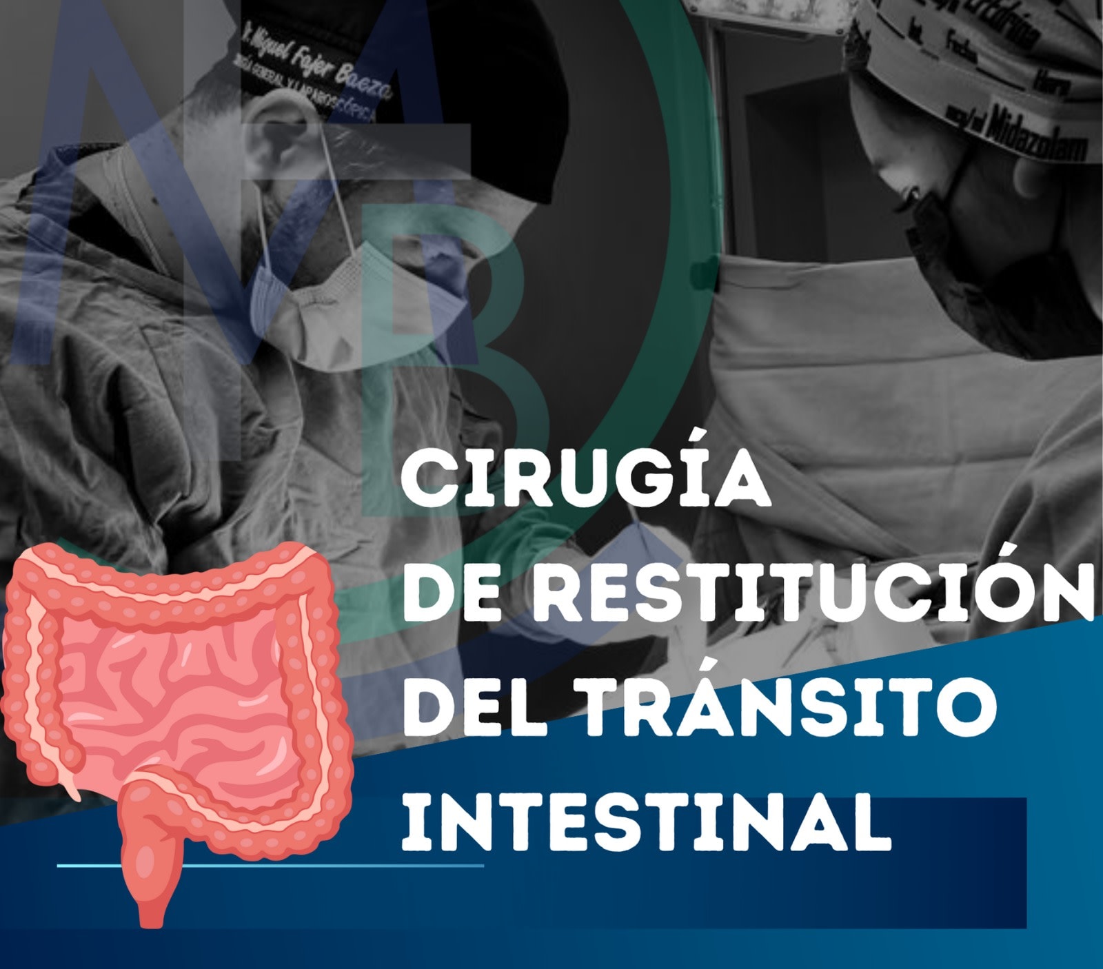 Cirugía de restitución de tránsito intestinal - Cirugía ...