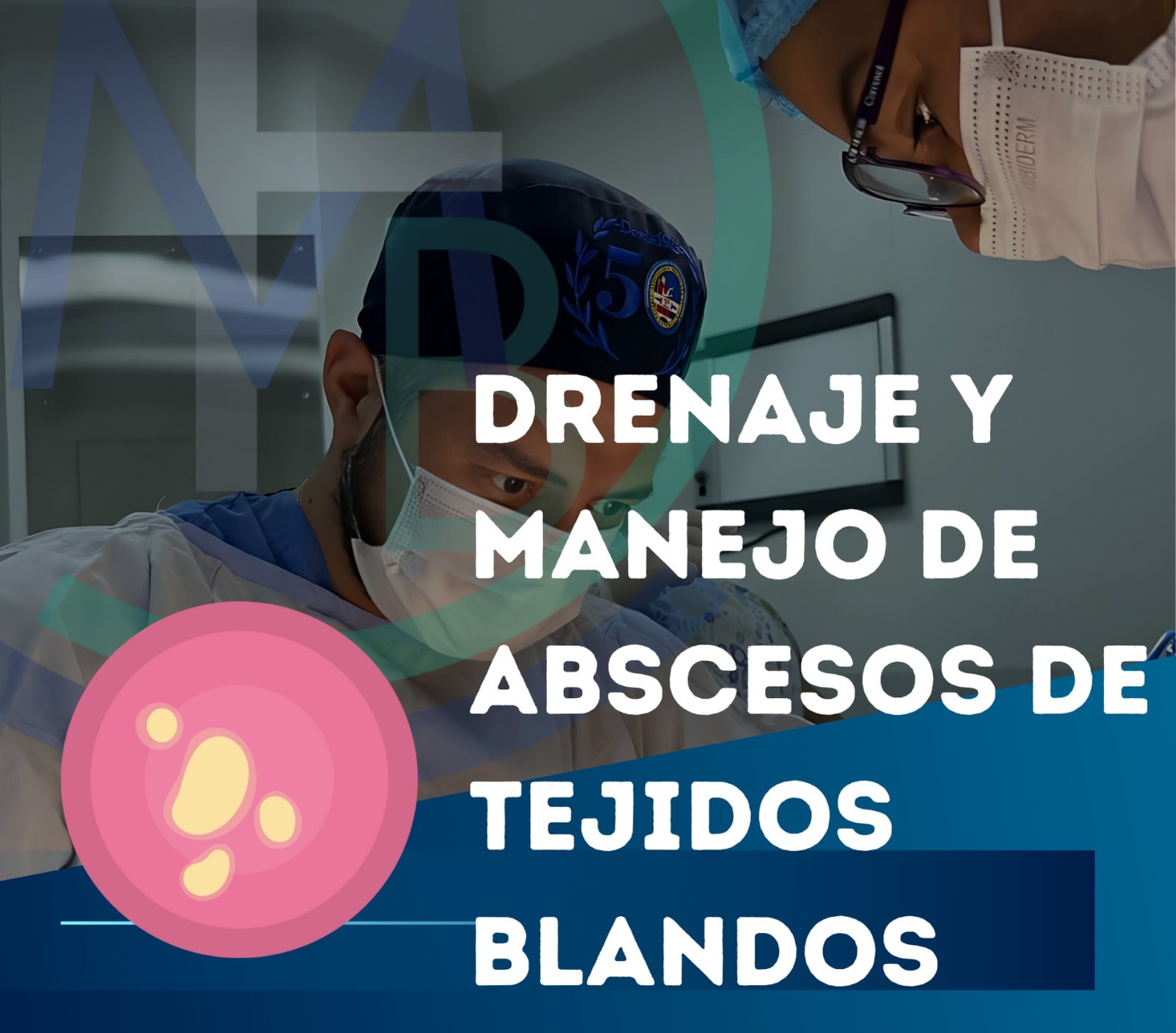 Drenaje y manejo de abscesos de tejidos blandos - Cirugía de tejidos ...