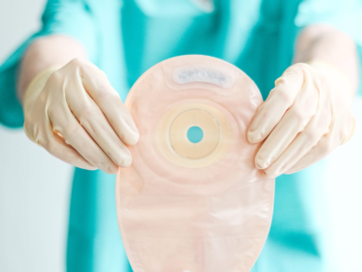 Ileostomy Support - Ostomy Care & Post-Surgical Support - Pro ...