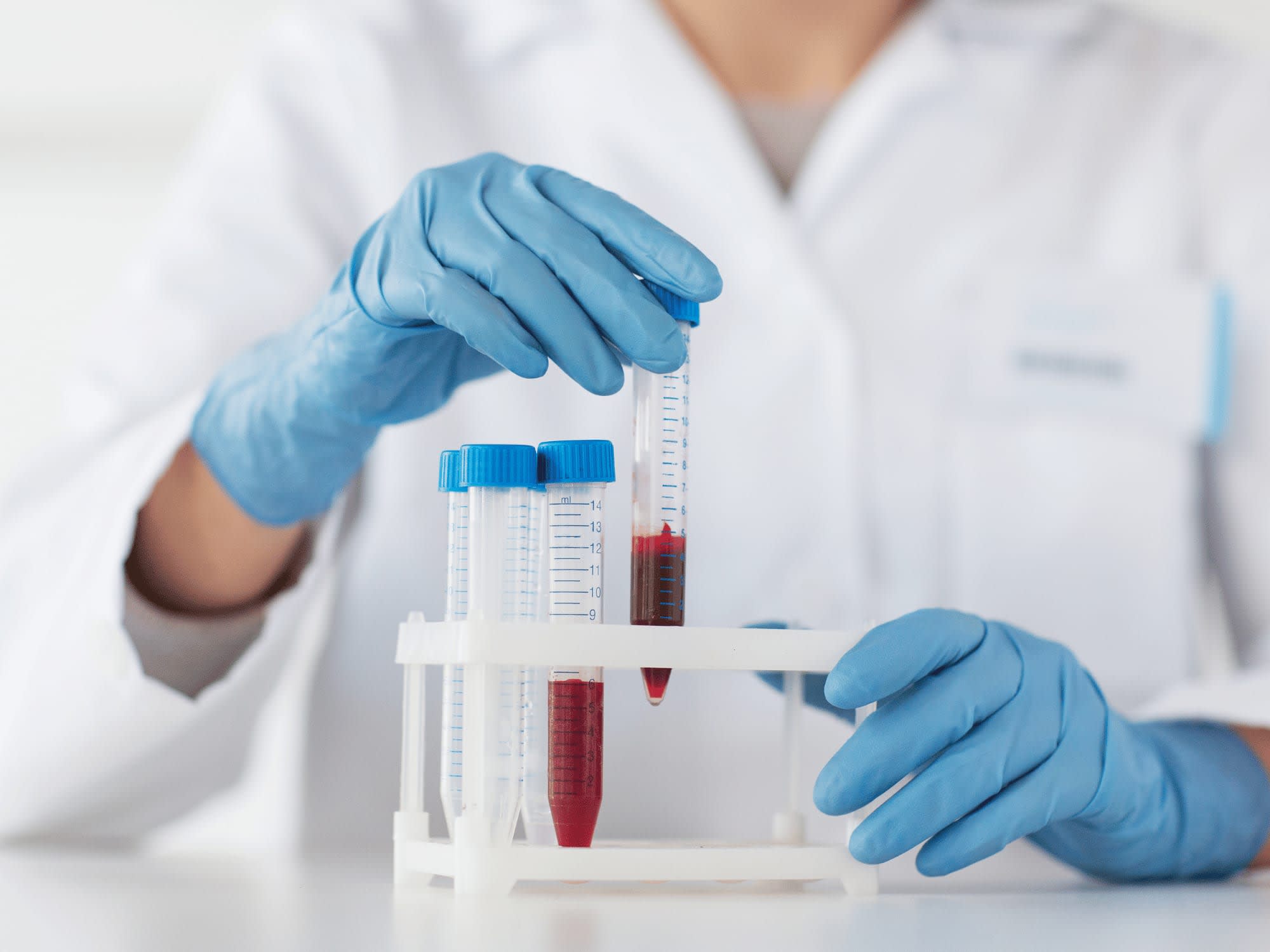 Basic Lab Tests - Mobile Lab Testing - Mobile Lab Testing | MedicOne ...