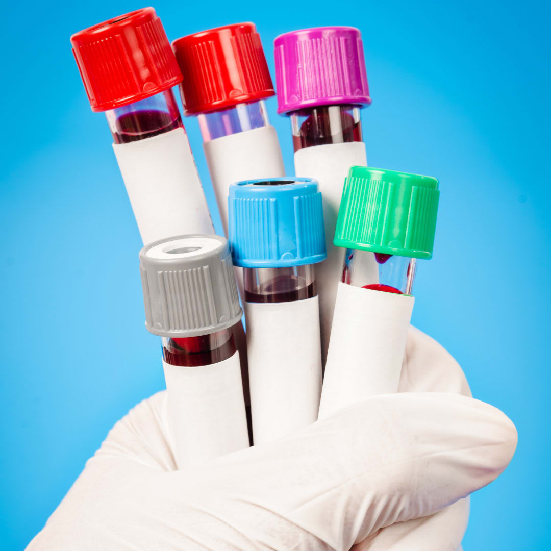 Special Collection Kit - Our Services - LabDraw Express | Mobile ...