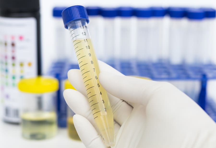 DOT Urine 5-Panel - Professional Testing Services - Anchored Horizons ...