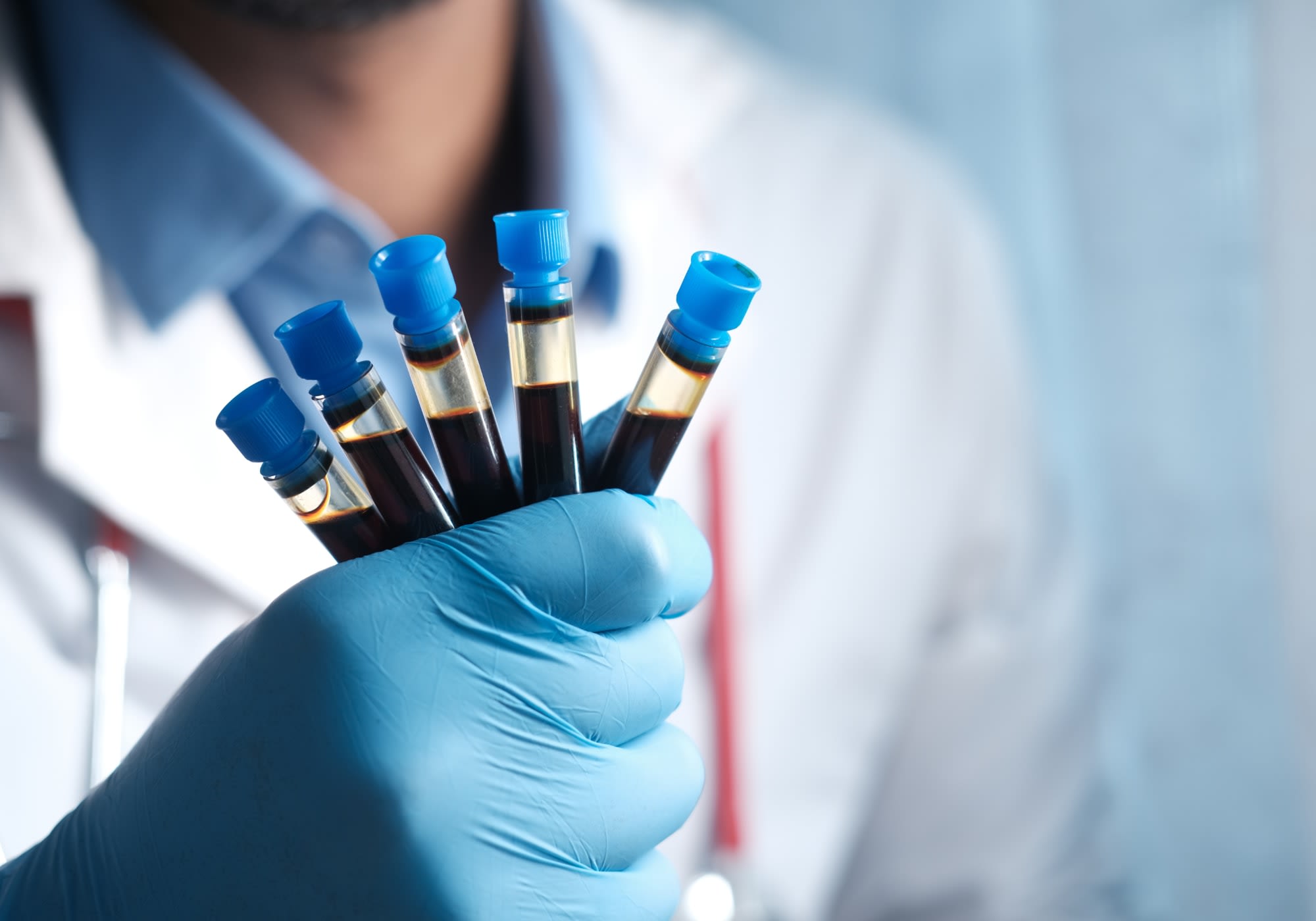 Coagulation Test (APTT, PT, Fibrinogen, AT, Heparin, D-Dimer, DRVVT, etc.)