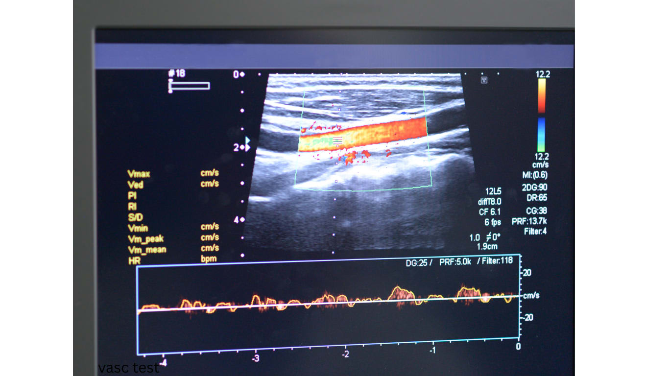 Vascular Testing - Vascular Imaging - CC Vascular Medicine | Premier ...