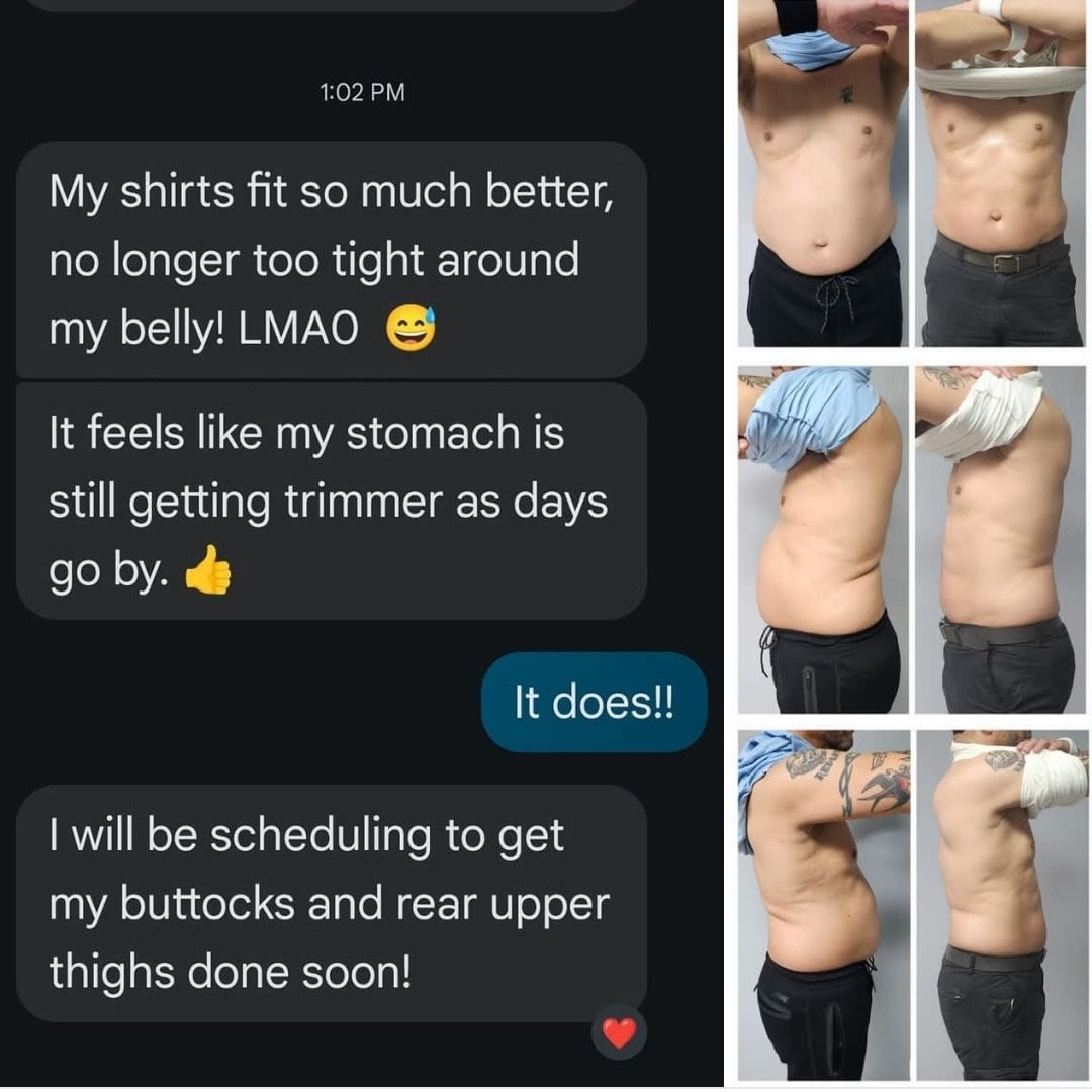 360 Non-Invasive Lipo - Body Sculpting - Simply Sculpted - Body ...